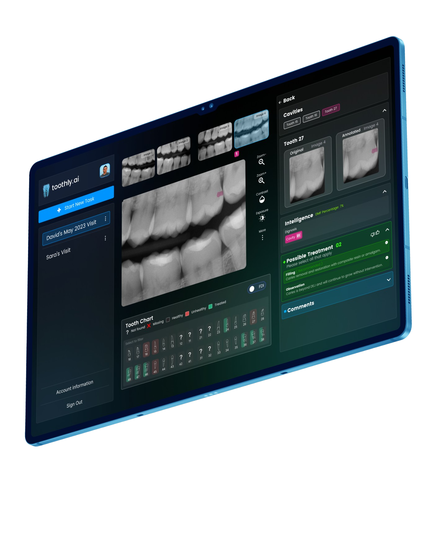Toothly: Dental Understanding ML Platform