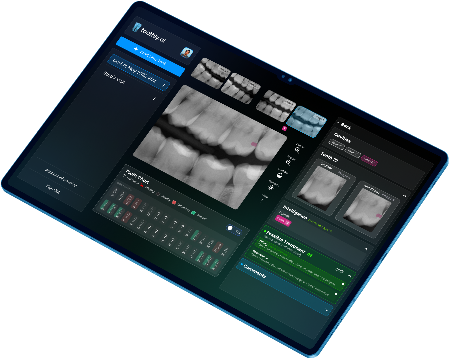 Toothly: Dental Understanding ML Platform